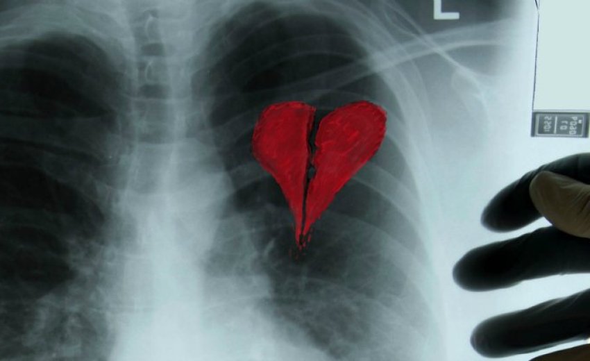 You Really Can Die From a Broken Heart | SikhNet