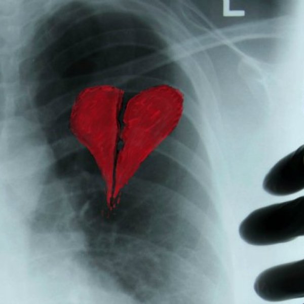 You Really Can Die From a Broken Heart | SikhNet